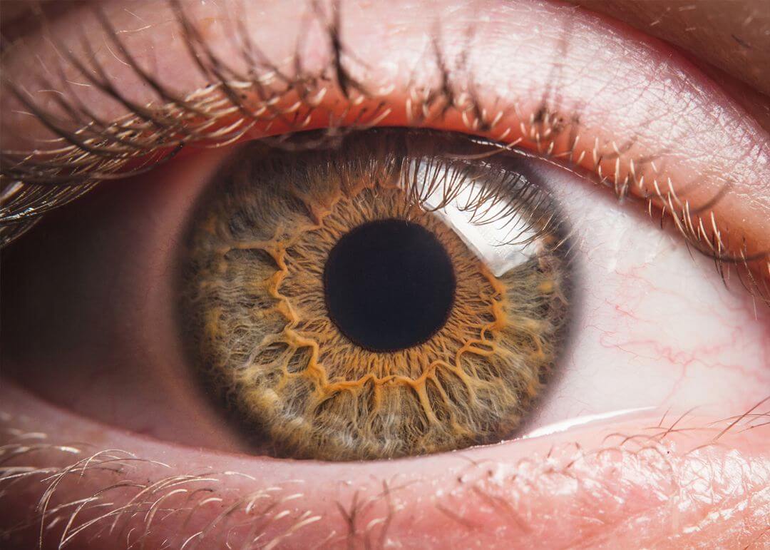 LASIK Dayton | Cornea Specialist Dayton | Mehan Eye